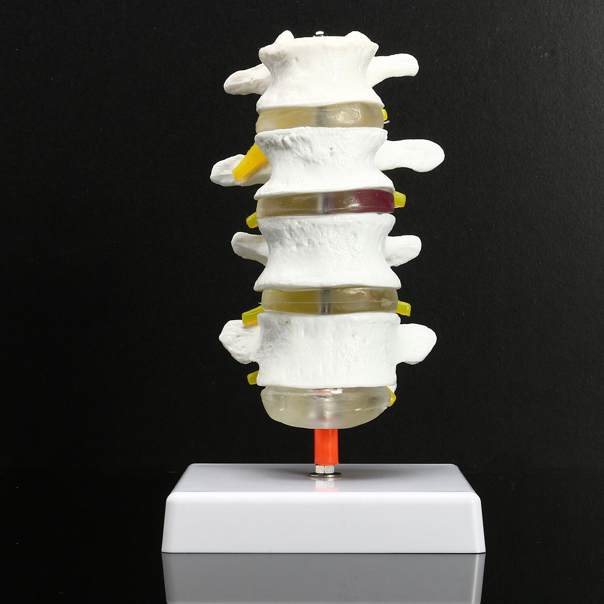 4 delige chiropractische menselijke anatomische lumbale wervels wervel ...